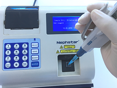 CE Mark factory Medical Nephelometer Nephstar - Goldsite Diagnostics Inc.,